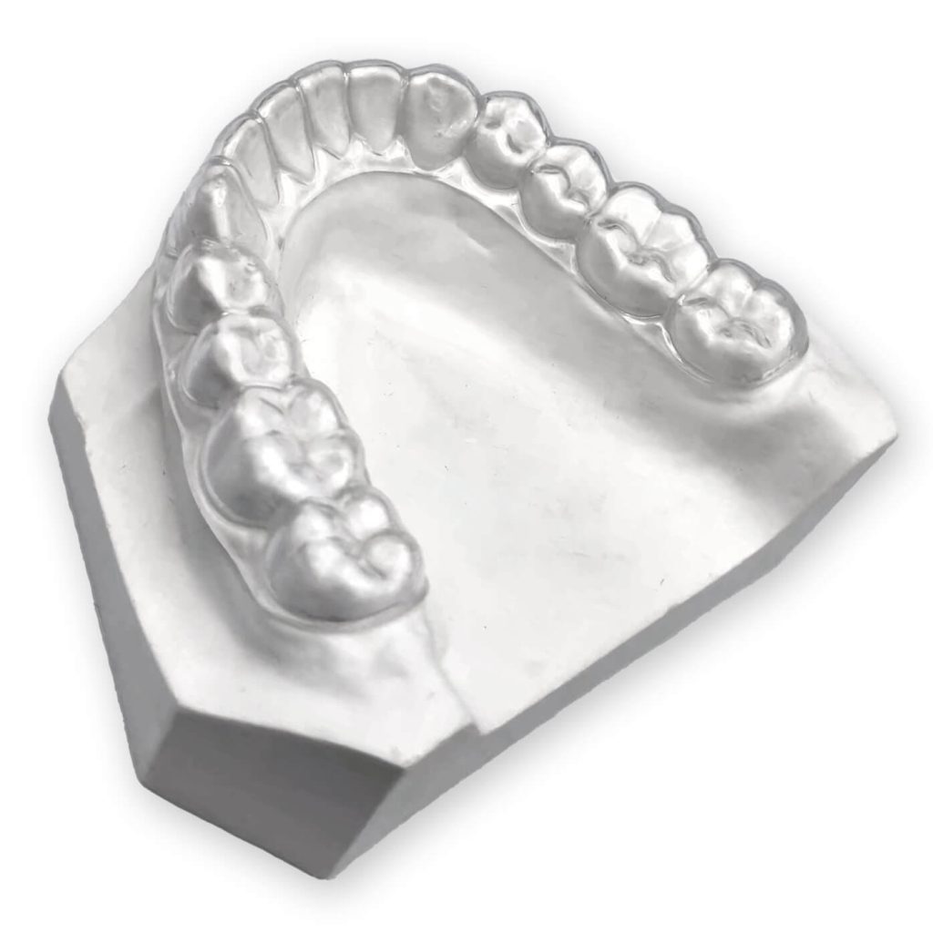 Custom Dental Appliances | Fake Braces, Expanders & Retainers ...