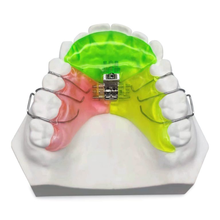 Buy Palate Expander Online | Expanders - BracesShop.com