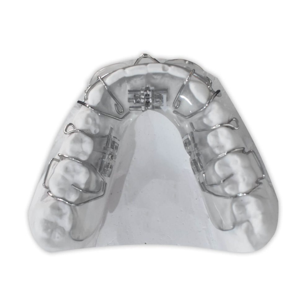 Modified Expansion Plate - BracesShop.com