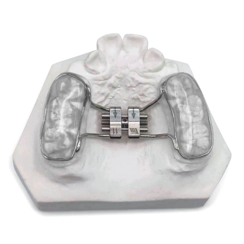 Buy Palate Expander Online | Expanders - BracesShop.com