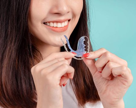 Custom Dental Appliances | Fake Braces, Expanders & Retainers ...