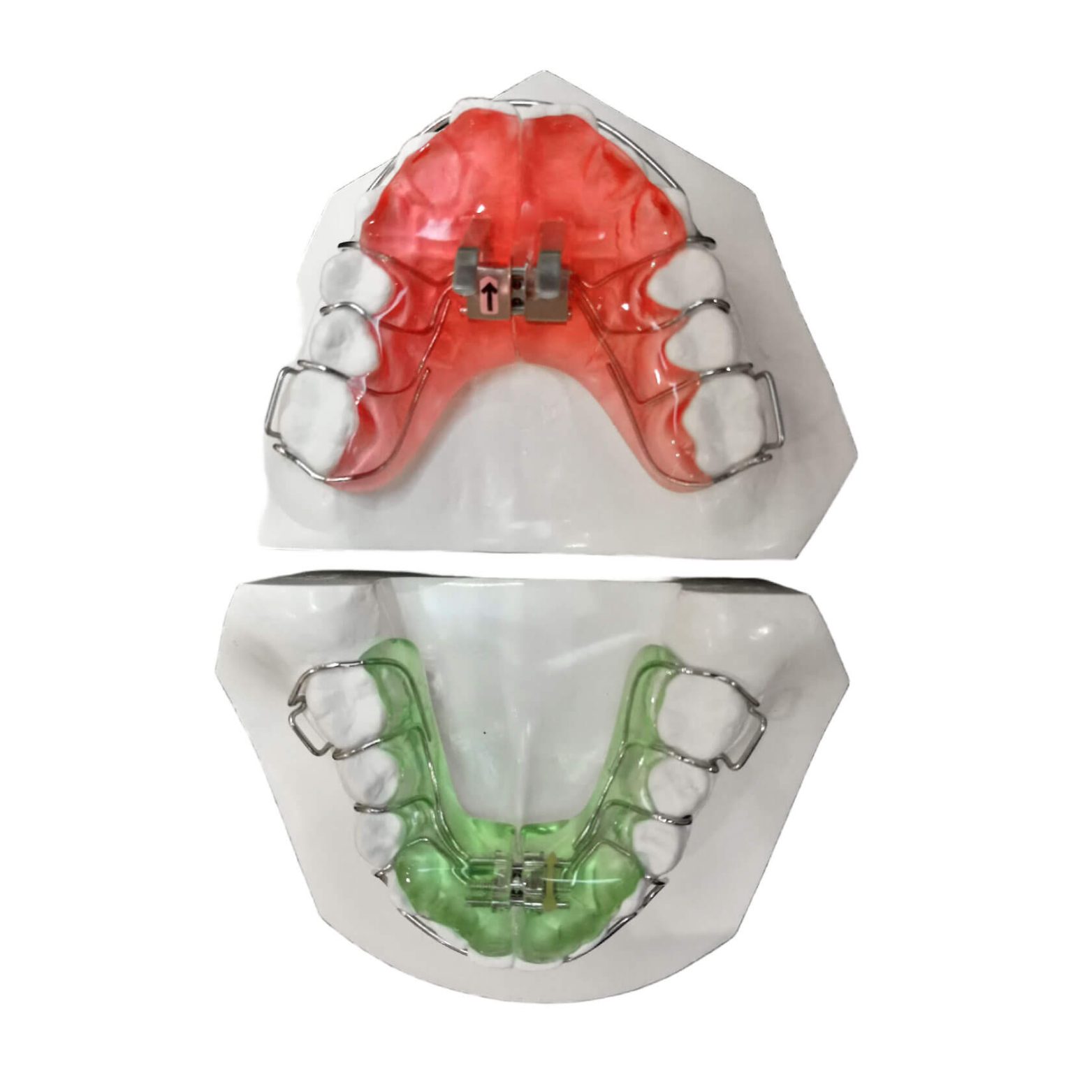 Bite Jumping Appliance (Sander II) - BracesShop.com