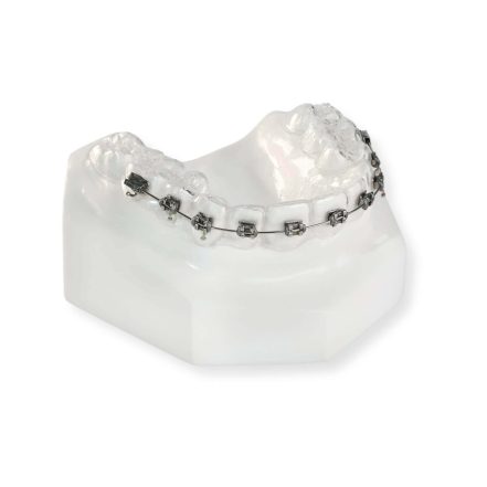 Fake Braces - Realistic Removable Braces for Photoshoots & Film ...