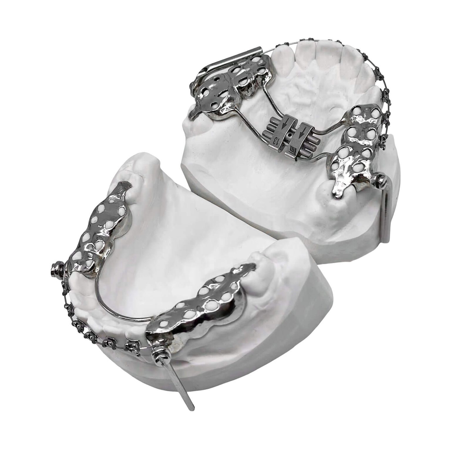 Herbst Appliance with RPE and Brackets - BracesShop.com