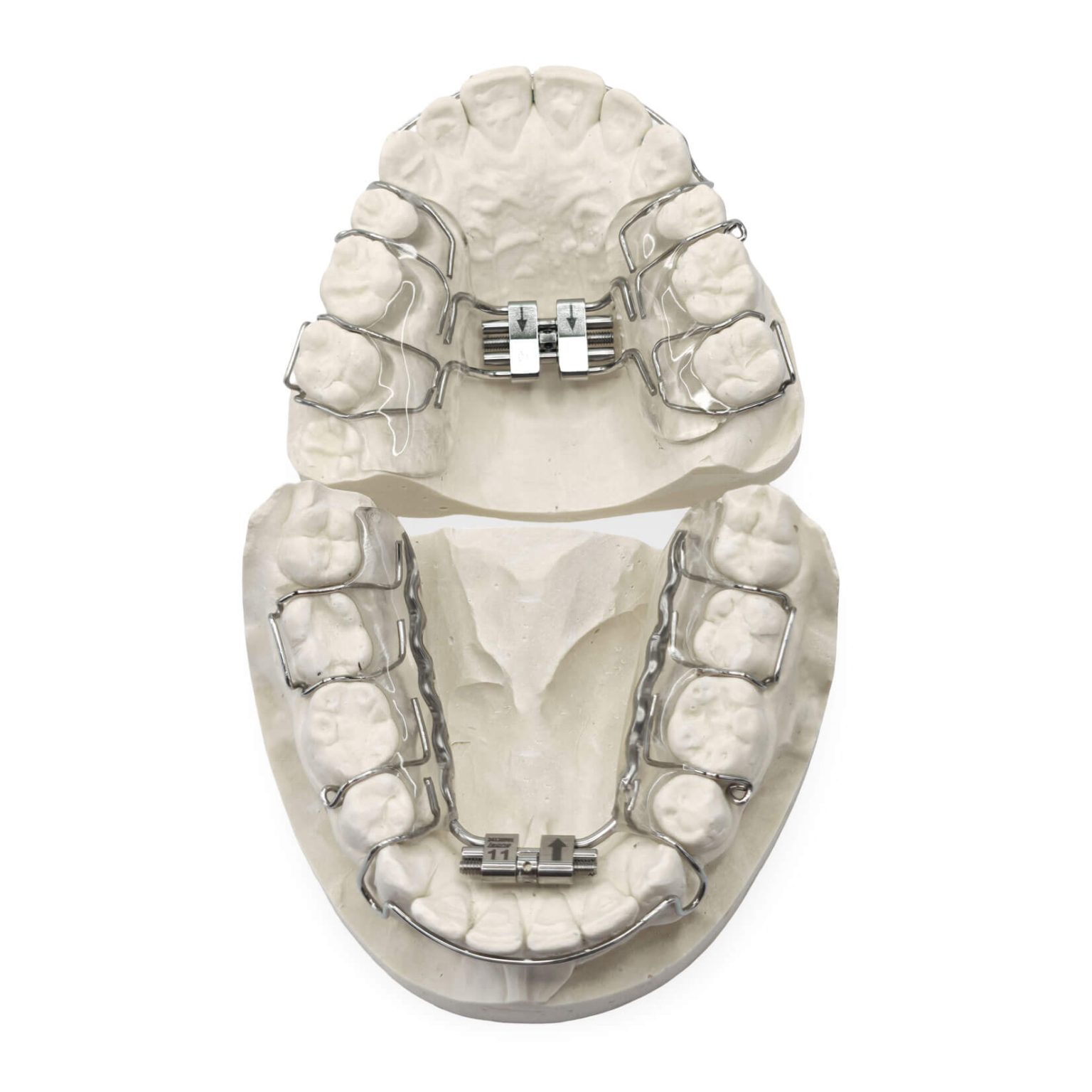 Removable Acrylic Rapid Palatal Expander (RPE) - BracesShop.com